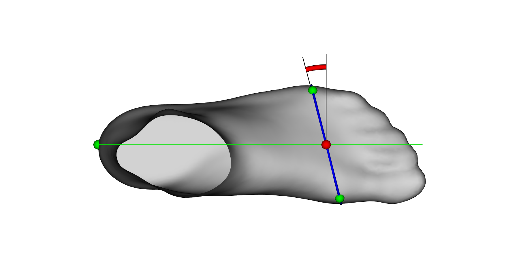 Feet Metrics Catalog