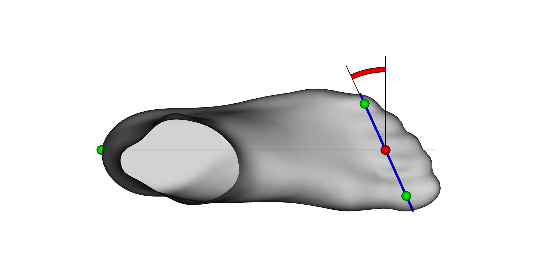 Feet Metrics Catalog